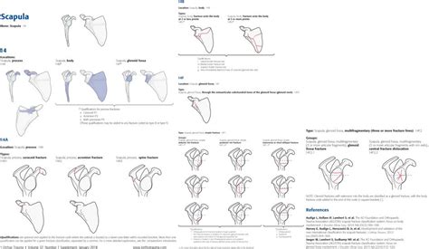 Scapula Fractures Clinical Tree