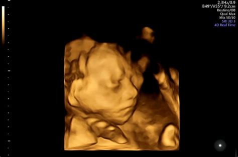 230125 임신 21주 2일 정밀 초음파 입체초음파 네이버 블로그