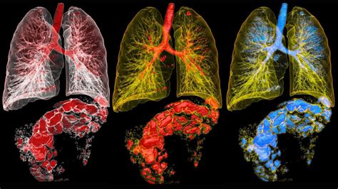 Ct Reconstruction Scrolller