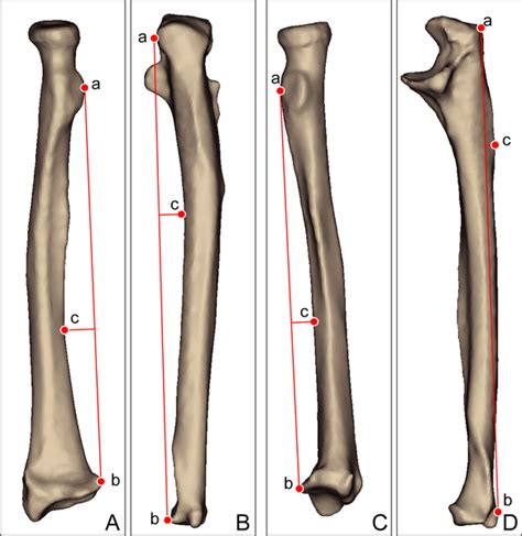 Ulna Bone