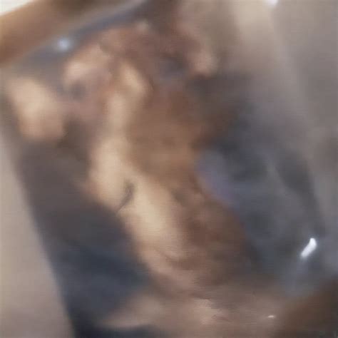 Understanding Radiation In Ct Scans Risks And Benefits