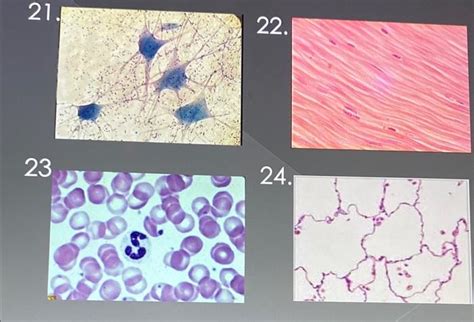 Solved 17 18 19 21 22 23 24