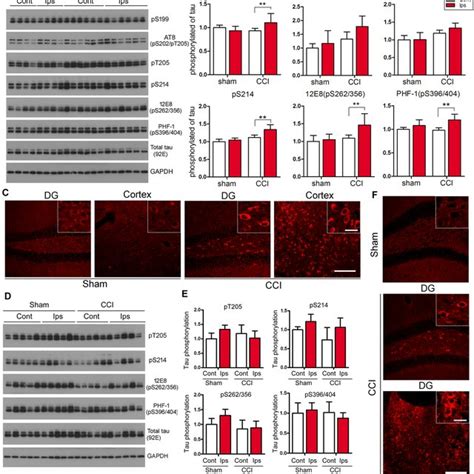 Cci Induces Accumulation Of Hyperphosphorylated Tau In The Brain Of Download Scientific Diagram