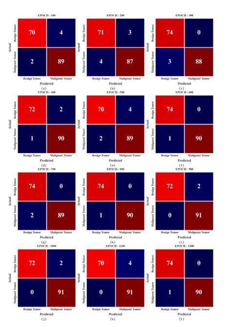 Tunicate Swarm Algorithm With Deep Convolutional Neural Network Driven