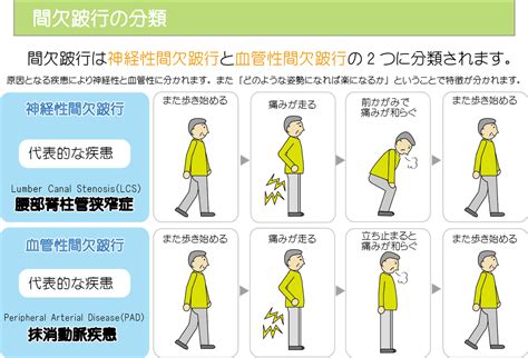 腰部脊柱管狭窄症 こみやま整骨院 三鷹