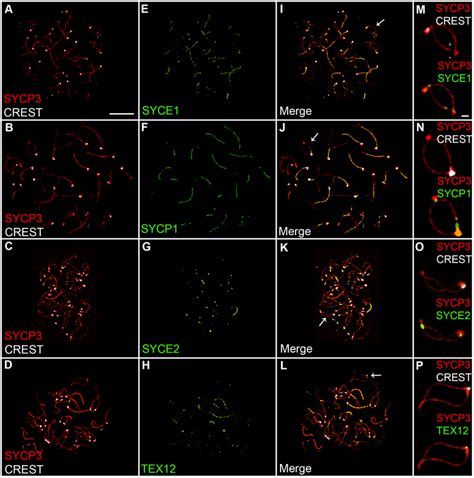 Localization Of Synaptonemal Complex Central Element Components During