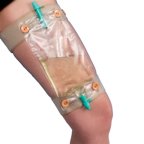 Foley Catheter Leg Bag Placement At Zane Stirling Blog
