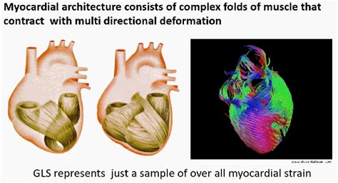 Limitations Of Gls Echo Dr S Venkatesan Md