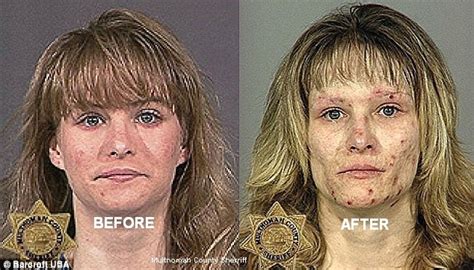 How Is The Addictiondisease Contracted Emans Website