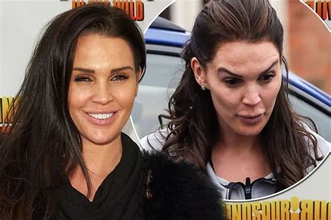 Danielle Lloyd Ignites Plastic Surgery Speculation As She Displays