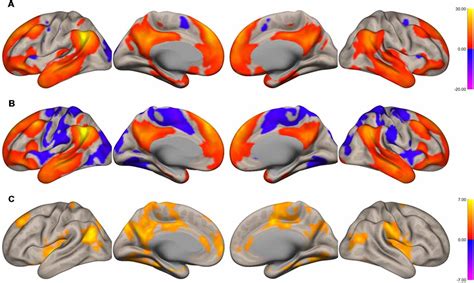 Frontiers Increased Functional Connectivity Of The Angular Gyrus During Imagined Music Performance