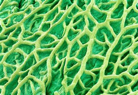 Gallbladder Surface Sem Stock Image C021 5232 Science Photo Library