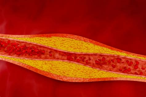 About Cholesterol Numbers