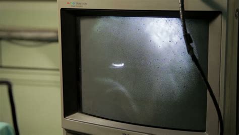 Urology Urological Examination Genitals Medical Camera Stock Footage Video 100 Royalty Free