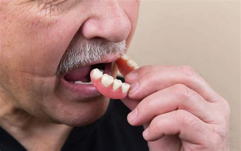 Can Dentures Replace One Missing Tooth Urban Living