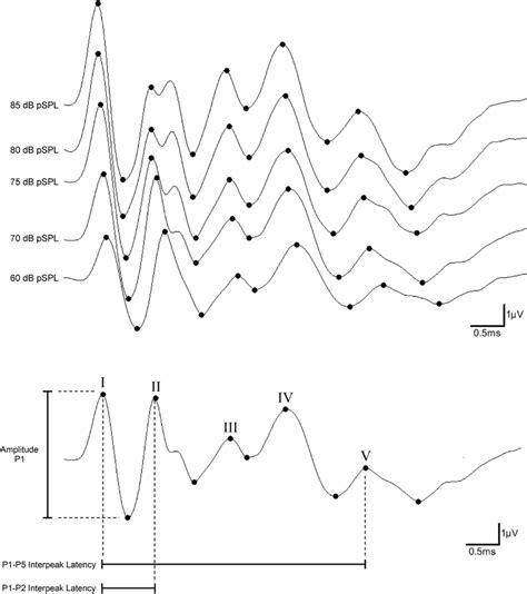 Example Of Abr Waveforms Stacked By Sound Level With Peaks And Troughs Download Scientific