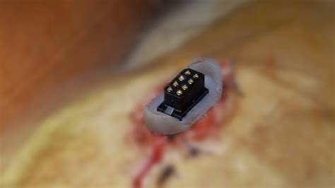 Electrode Array Implantation On The Abdominal Vagus Nerve In Rats For