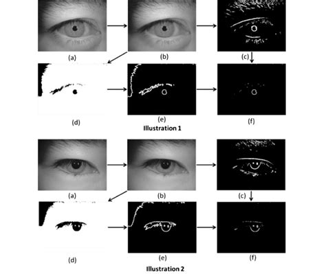 Fig A1 Proposed Edge Map Generation Technique For Pupil Detection Download Scientific