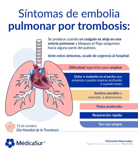 Causas De Embolia Pulmonar