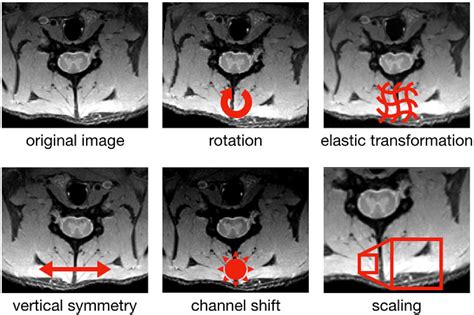 Figure 3 From Open Source Pipeline For Multi Class Segmentation Of The