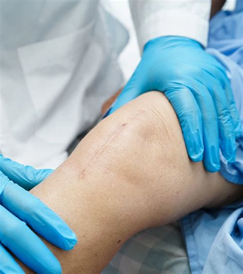Does Urgent Care Remove Stitches Staple And Stitch Removal
