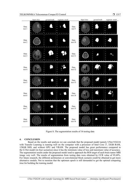 Unet Vgg16 With Transfer Learning For Mri Based Brain Tumor
