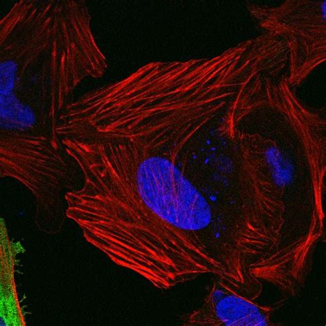 Any Suggestions On A Dapi Hoechst Artifact With Lipofectamine 3000
