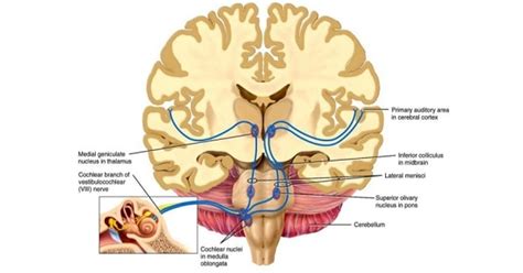 Cochlear Nerve Pathway