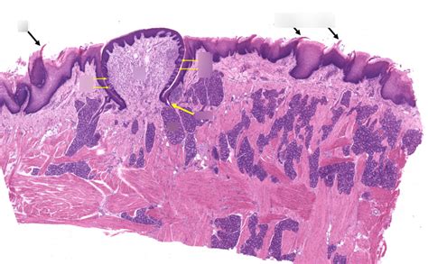 Papillae Diagram Quizlet
