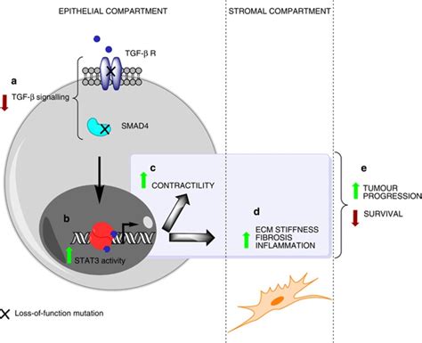 Building Up The Tension Between The Epithelial And Stromal Compartment In Pancreatic Ductal
