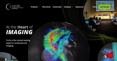 Cardiac Ct Scan Vs Angiogram Whats The Difference Circle