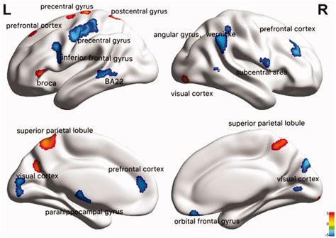 Global Functional Connectivity Density Alterations In Healthy