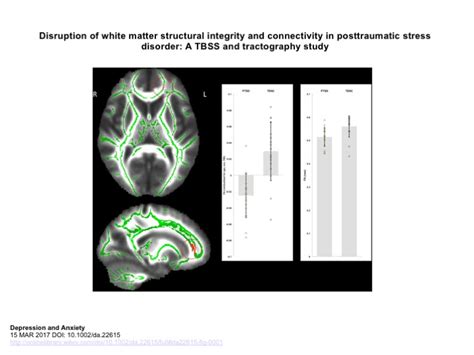 results of tract based spatial statistics tbss using a whole brain