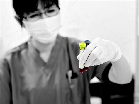 What Is The D Dimer Normal Range