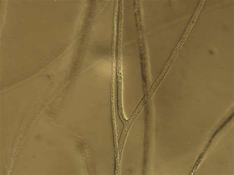 Pythium Foliar Blight K State Turfgrass