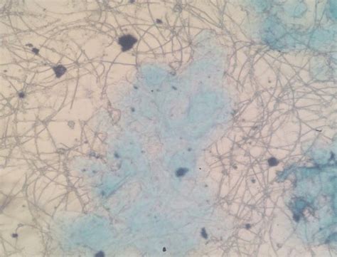 Vaginal Smear An Arrow Pointed At The Presence Of Sperms Download Scientific Diagram