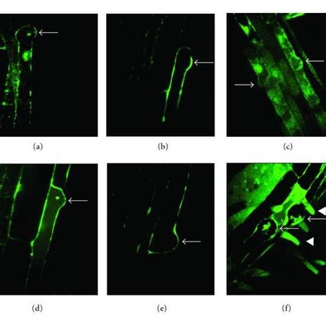 Nbt Staining Indicating The Production Of Superoxide Radical In Root Download Scientific