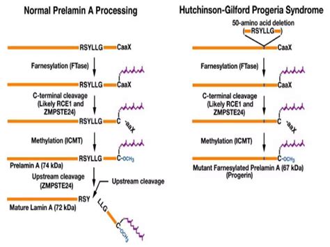 Hutchinson Gilford Progeria Syndrome Ppsx