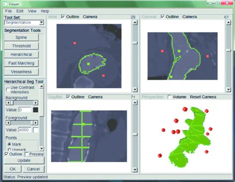 Applying Hierarchical Segmentation By Placing Interior Points Green Download Scientific