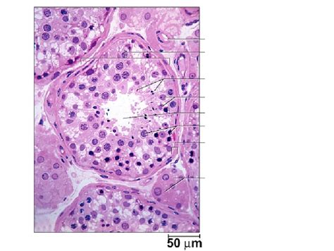 272 The Testis And Associated Structures Light Micrograph Of