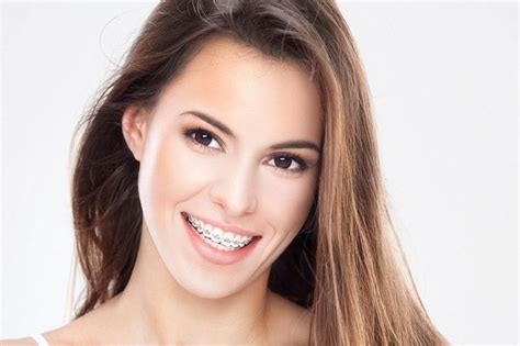 10 Instructions To Take Care Of Your Retainers City Smiles Dental And Orthodontics Orthodontists