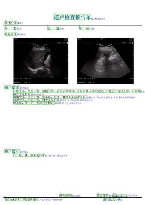6 087张体检报告ocr数据