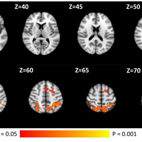 Fmri N Back Task Performance Download Table