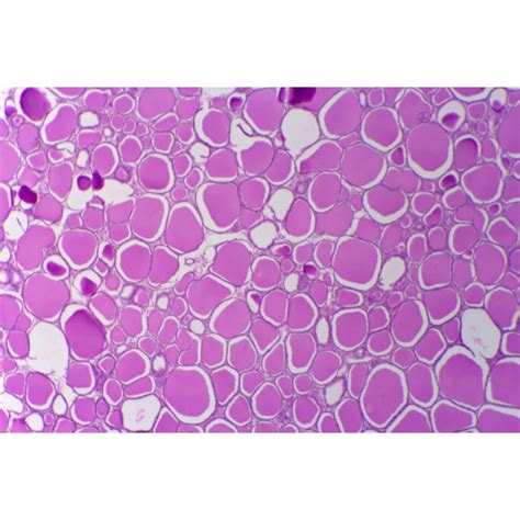 Simple Cuboidal Epithelium In Sec Of Human Thyroid Gland Medical