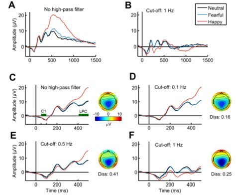 Pitfalls Of Filtering The EEG Signal Sapien Labs Shaping The Future Of Mind Health