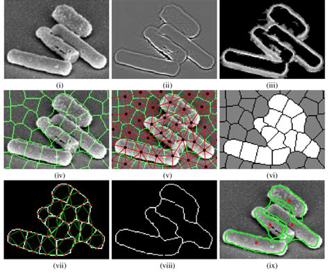 Application Of Detcic To A Clostridium Difficile Cell Image Acquired Download Scientific