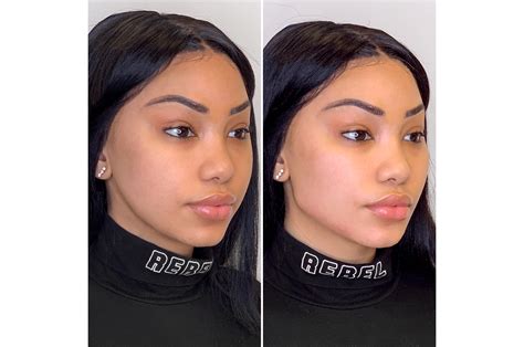 3 Ways To Get A More Defined Jawline Justinboey