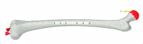 Schematic Diagram Of The Femoral Prosthesis Restraint And Load Application Download