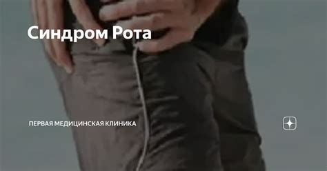 Синдром Рота Первая Медицинская Клиника Дзен