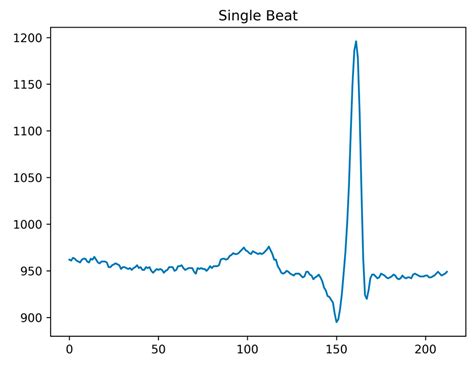 An Electrocardiogram Classification Using A Multiscale Convolutional